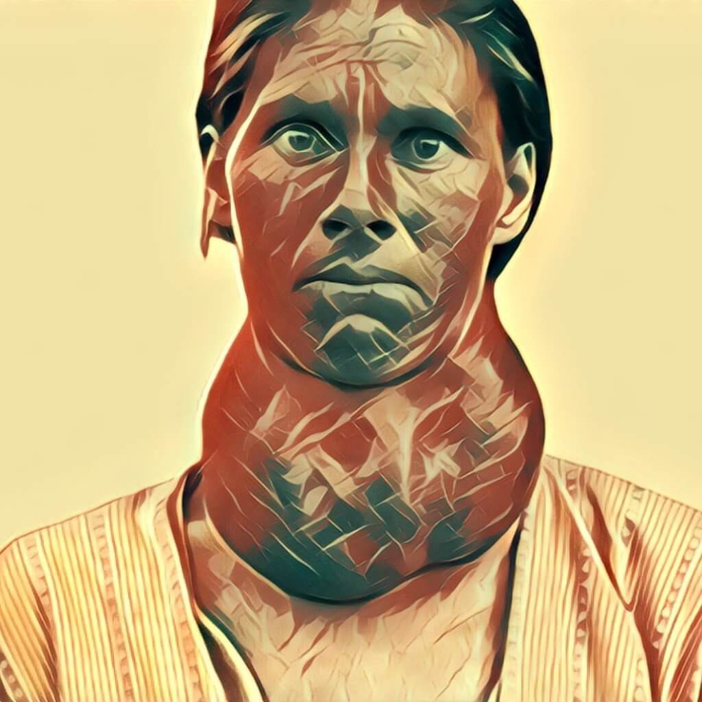 Kropf - Traum-Deutung