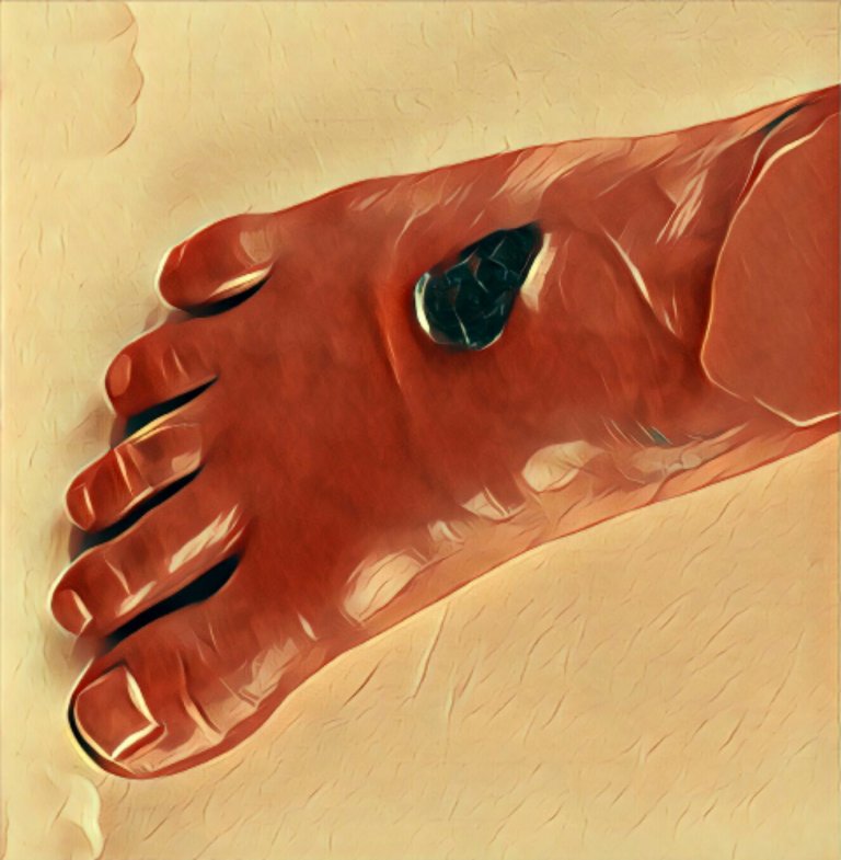 Tierbiss - Traum-Deutung